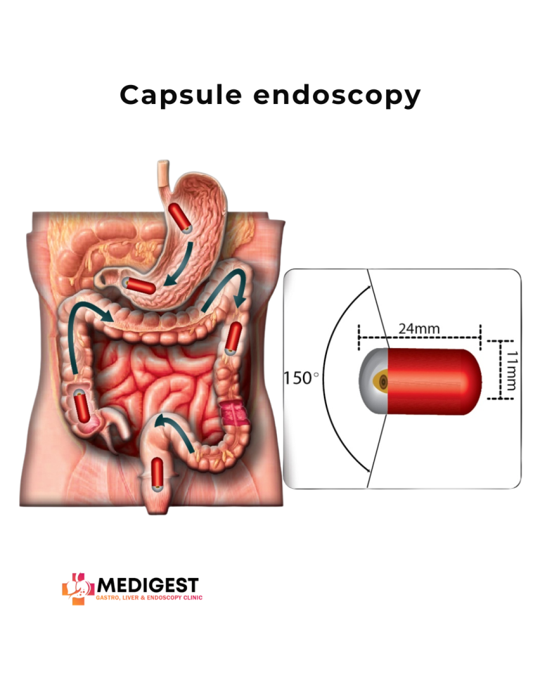 Types of Endoscopy: Upper GI, Colonoscopy, & More | Dr. Shrihari Anikhindi